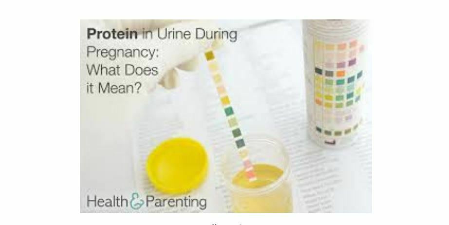 Pengertian dan Faktor yang Mempengaruhi Protein Urine - Jurnal